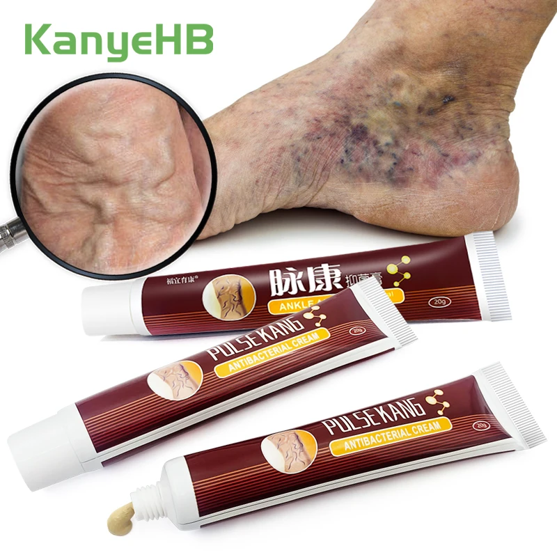 3pcs-Varicose-Veins-Cream-Varicose-Vein-Treatment-Ointment-Relieve-Vein ...