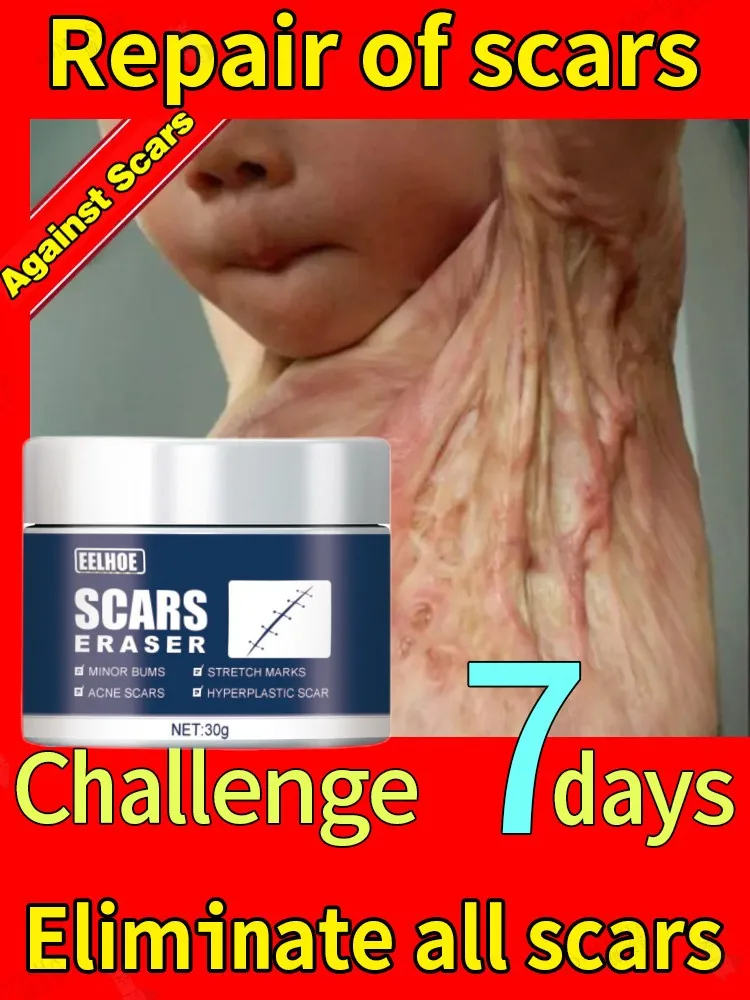 Eraser Challenge Effects