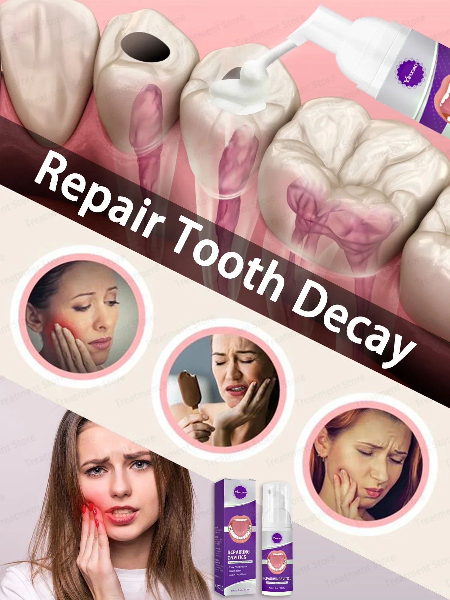 Anti Decay Toothpaste Dental Caries Repair Serum Prevent Tooth Decay ...