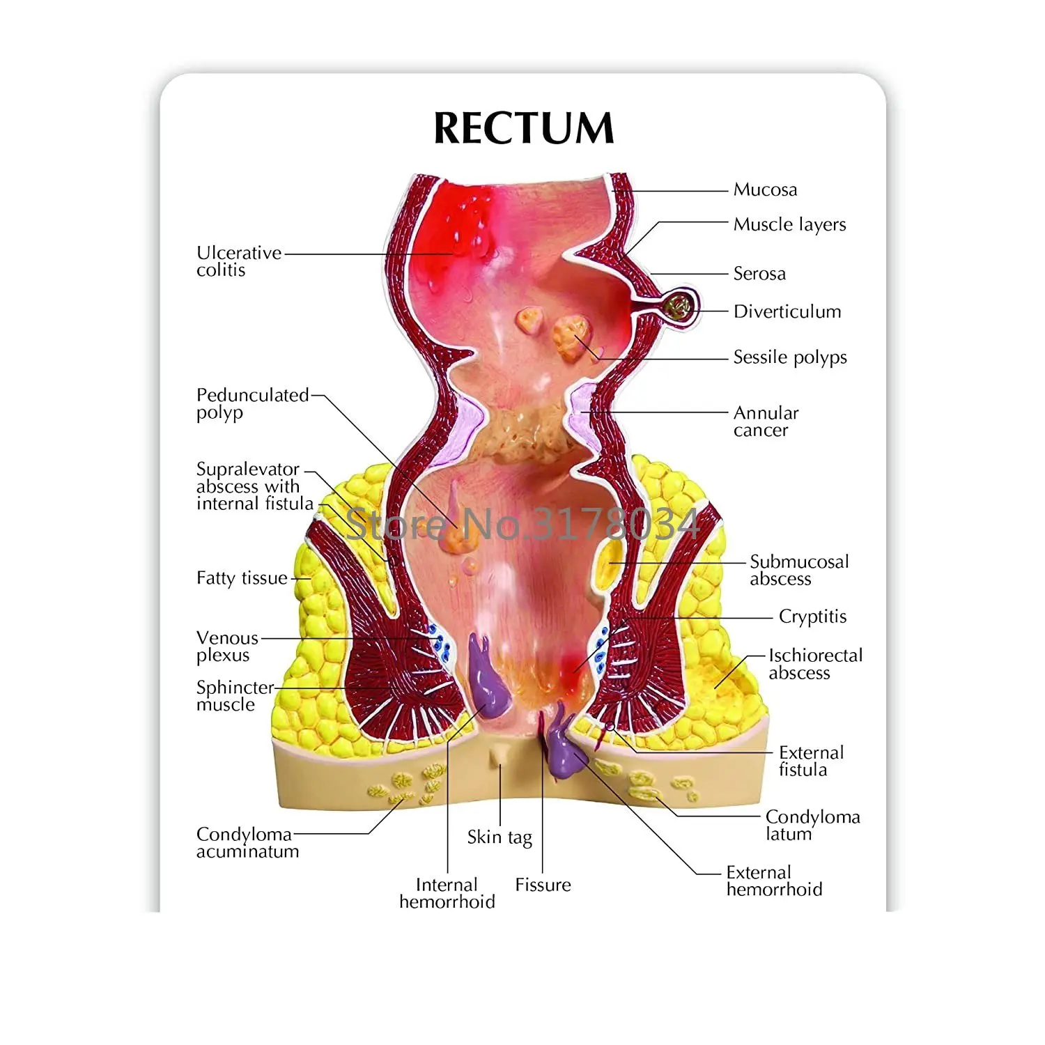 Anatomia Del Recto