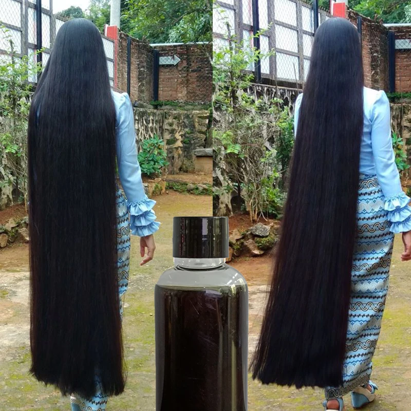 50ml Hand Made Pure Vegetable Hair Essence Preventing Hair Loss Chinese ...