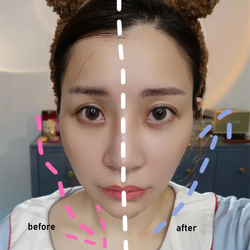 Elastic-Kinesio-Tape-for-Face-Reduce-Nasolabial-Lines-Neck-Eyes-Lifting ...