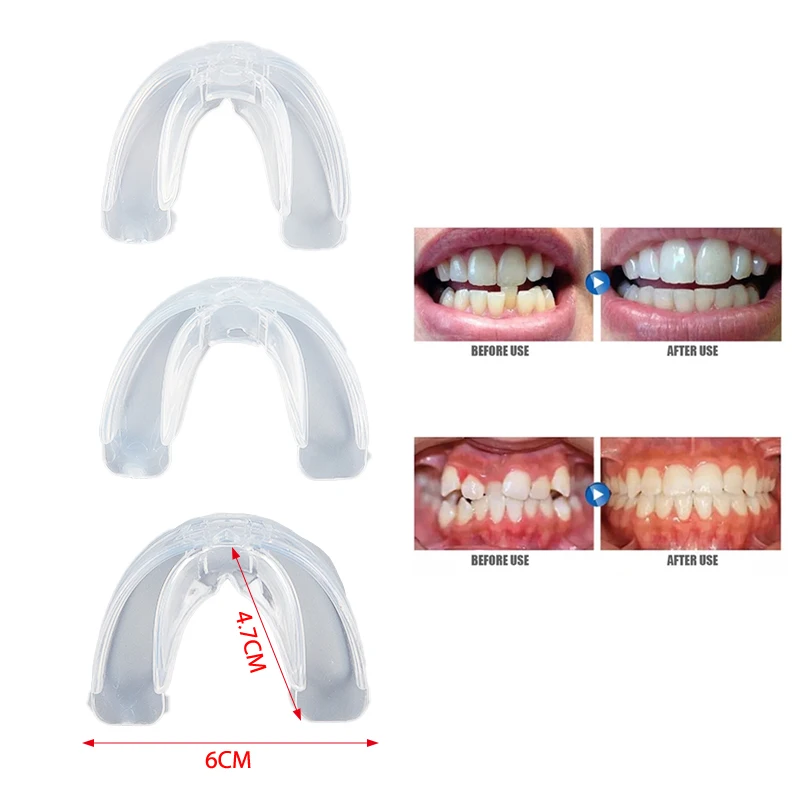 Tooth Dental Orthodontic Appliance Trainer Professional Alignment ...