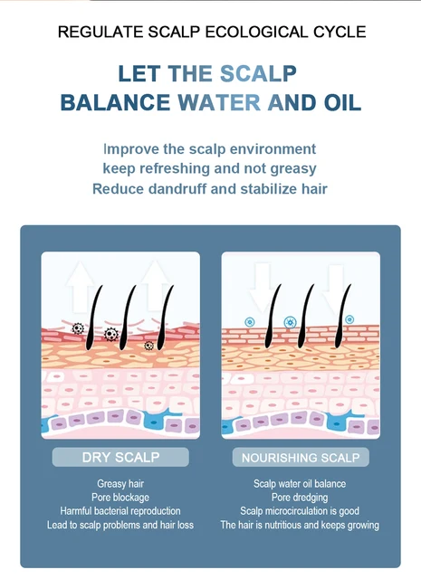 Dandruff Scalp Diagram