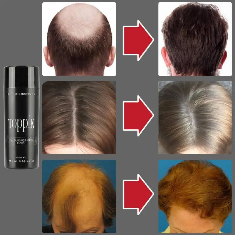 Toppik-Hair-Loss-Building-Fibers-Hair-Fibers-Regrowth-Powders-Keratin ...
