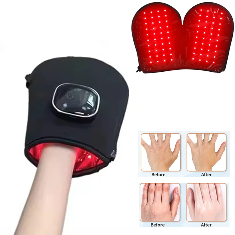 Red&Infrared Light Therapy Double Side LED Device for Hand Pain Relief ...
