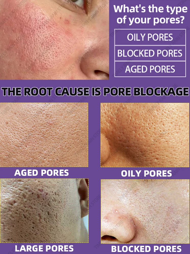 Large Open Pore