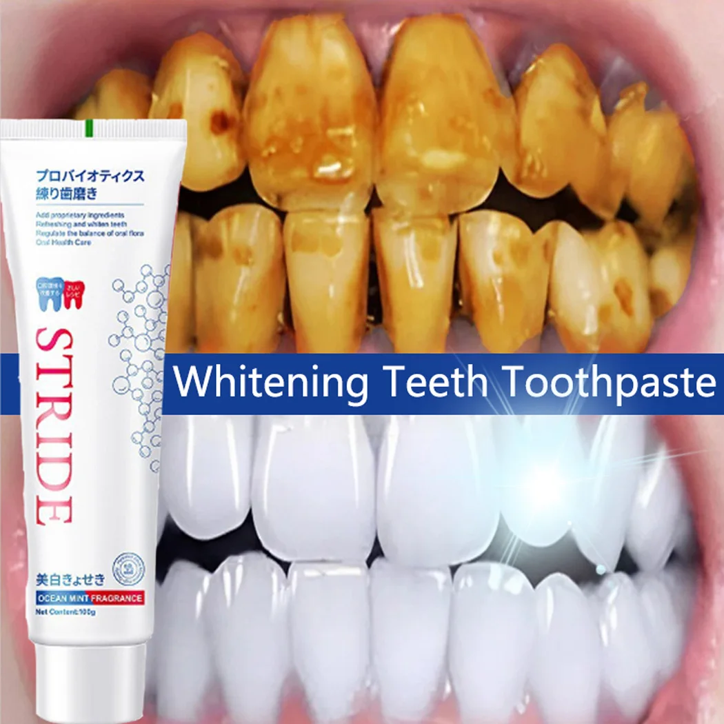 Whitening-Teeth-Toothpaste-Dental-Calculus-Remover-Fresh-Breath ...