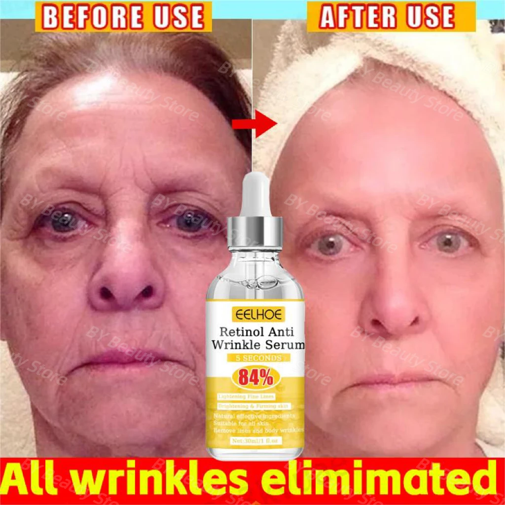 Retinol-Wrinkle-Remover-Face-Serum-Anti-Aging-Lifting-Firming-Fade-Fine ...