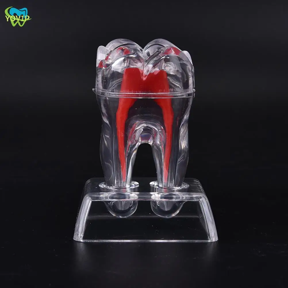 Large-Tooth-Molar-Model-Separable-Teaching-Demonstration-Model ...