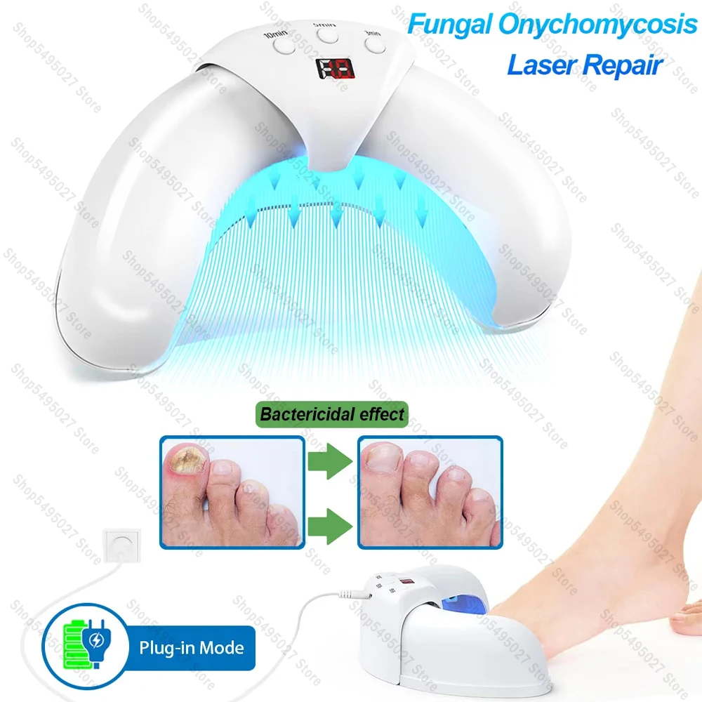 Nail-Fungus-Laser-Device-Toenail-Laser-Therapy-Machine-Anti-Fungal ...