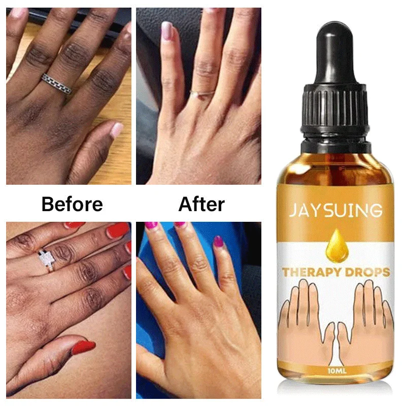 Body Whitening Soro Dark Knuckles Rápido Clarear Clareamento Pele Negra ...