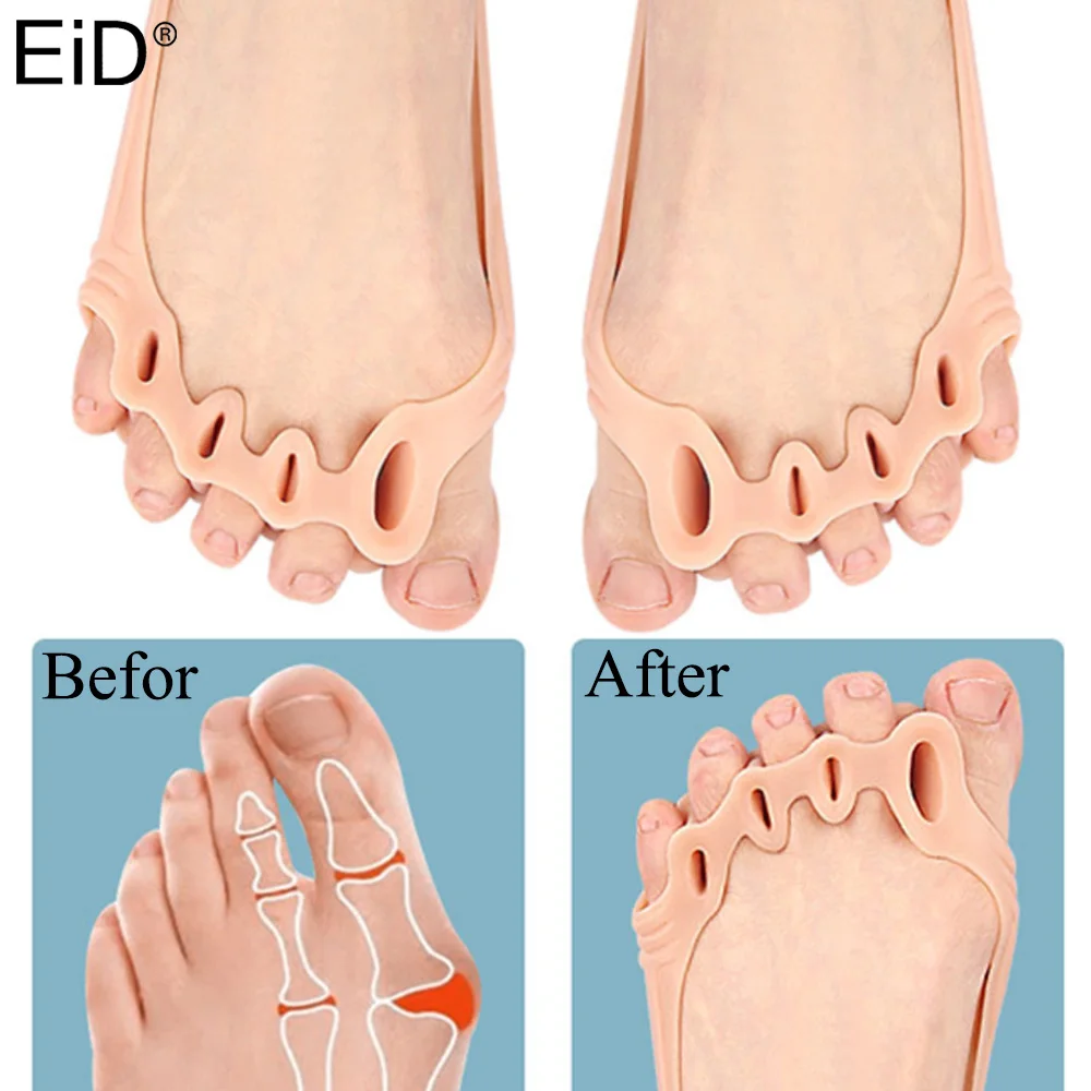 5-Holes-Silicone-Toe-Separator-Metatarsal-Pads-Pain-Relief-Forefoot ...