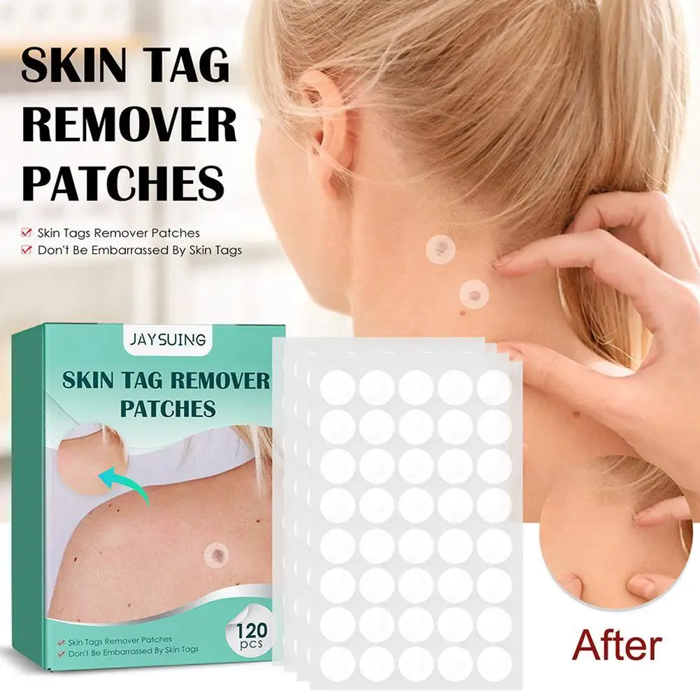 120pcs/box Warts Remover Plaster Skin Tags Remover Wart Treatment Patch ...