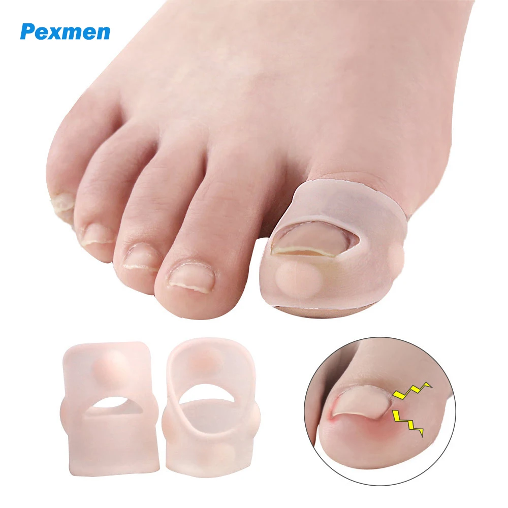Pexmen 2pcs/pair Gel Ingrown Toenail Corrector Sleeves Big Toe Nail ...