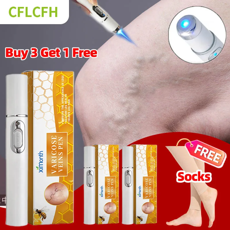 3Pcs-Varicose-Veins-Laser-Therapy-Pen-For-Men-And-Women-Varicose-Vein ...