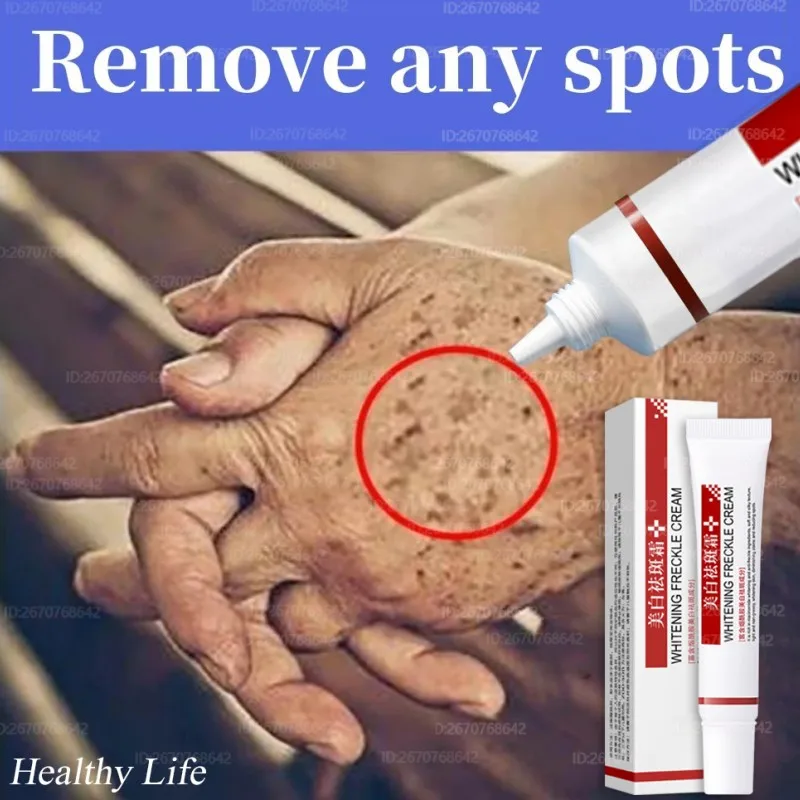 Creme-clareador-melanina-para-mulheres-rosto-r-pido-clareamento-pele ...