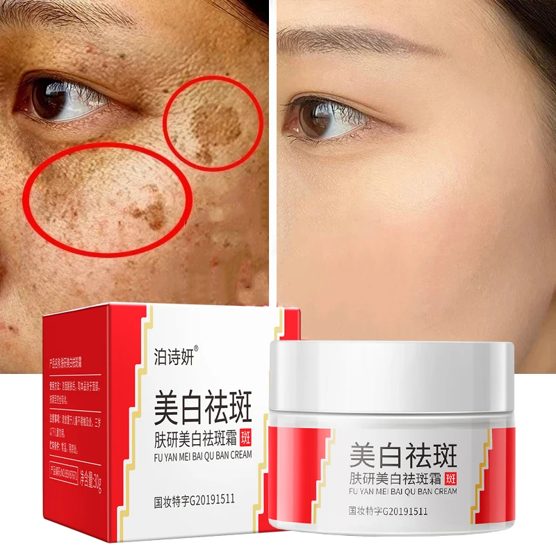 효과적인 미백 주근깨 크림 기미 제거 여드름 반점 색소 멜라닌 다크 스팟 색소 침착 모이스처라이징 젤 스킨 케어