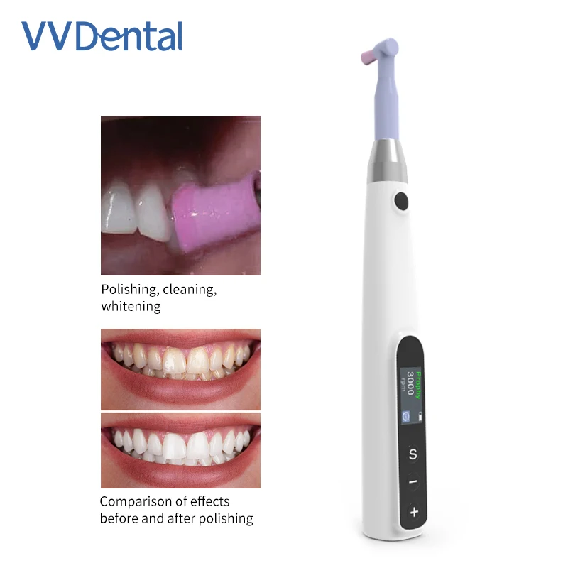 VVDental-Prophy-Motor-3000rpm-Wireless-Rechargeable-Polishing ...