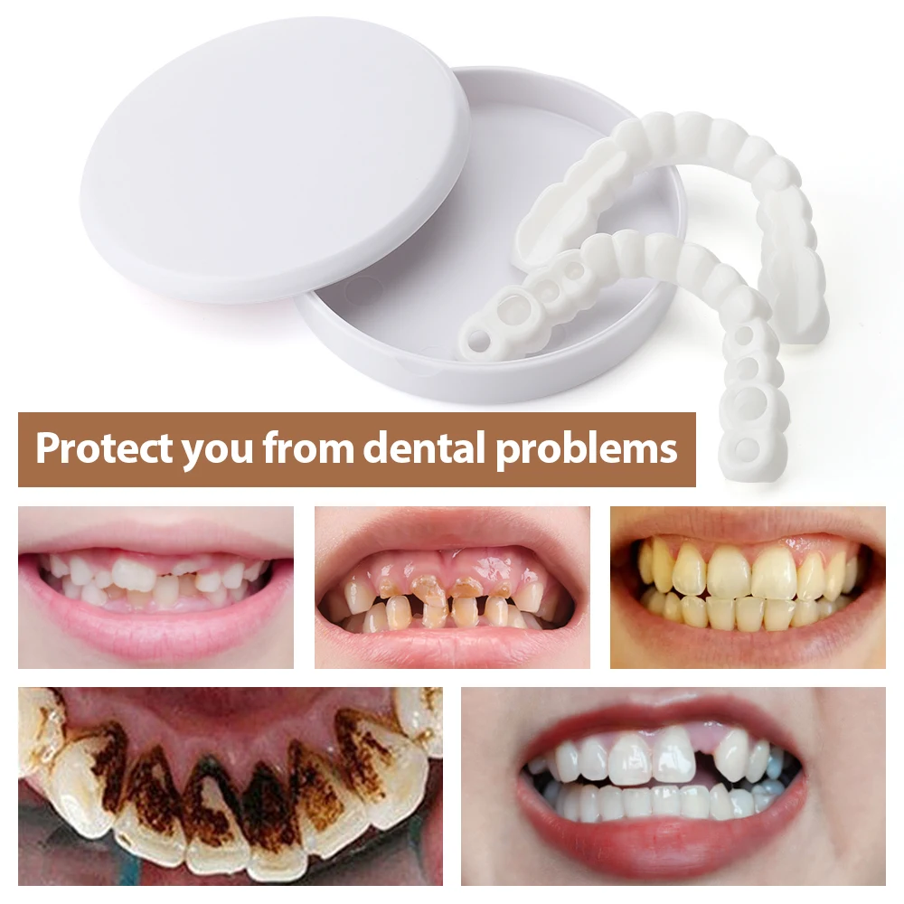 Fake Braces With Tooth Missing For A Tooth