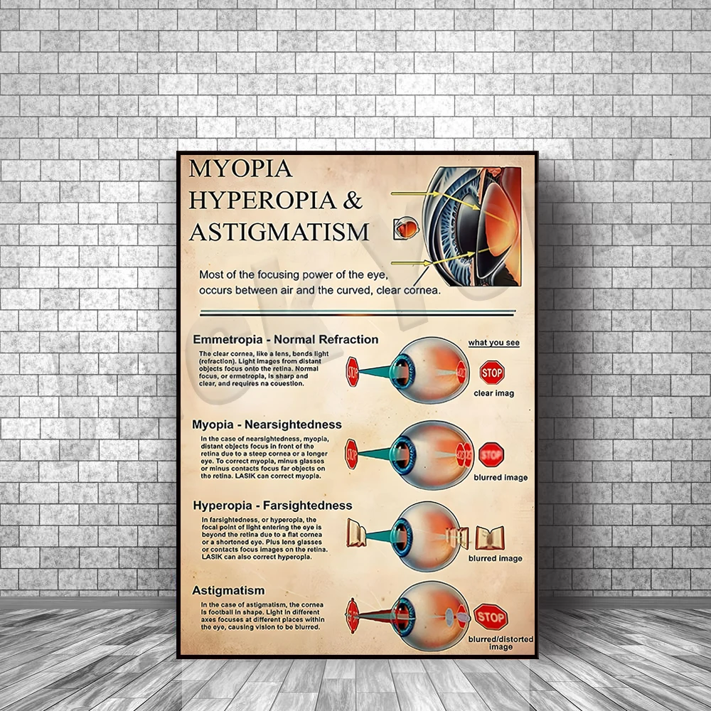 Myopia Hyperopia Astigmatism