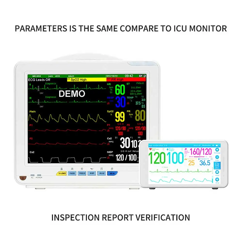 Ecg Machine Screen
