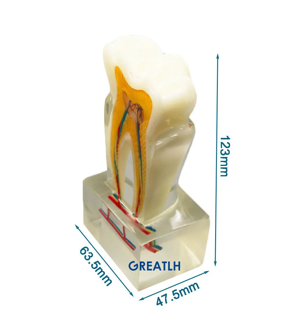 Orthodontic Model 6:1 Teeth Teaching With Clear Base Nerve Anatomical ...