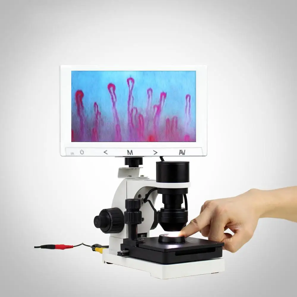 nailfold-Capillary-Microcirculation-Microscope.jpg