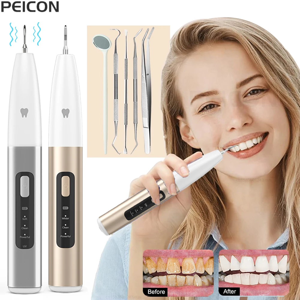 Ultrasonic-Dental-Tartar-Removal-Teeth-Tartar-Eliminator-Dental-Scaler ...