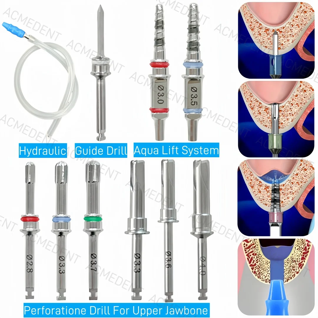 Dental Maxillary Sinus Lift Membrane Water Rising Hydraulic Lifter Aqua ...