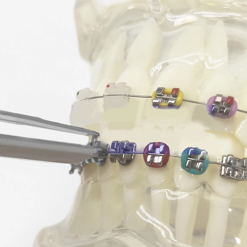 Dental-Opener-Oral-Care-Tool-For-Opening-Orthodontic-Self-Ligating ...