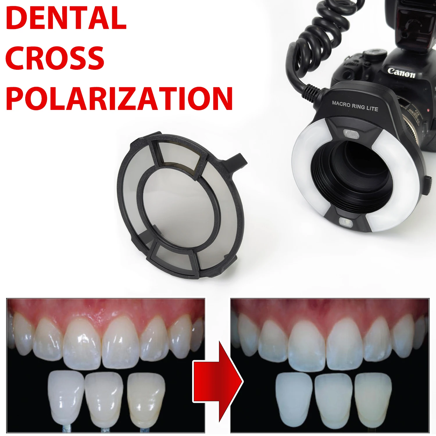 Cross-Polarizing-Lens-Filter-For-Dental-Photography-No-Glare-No ...