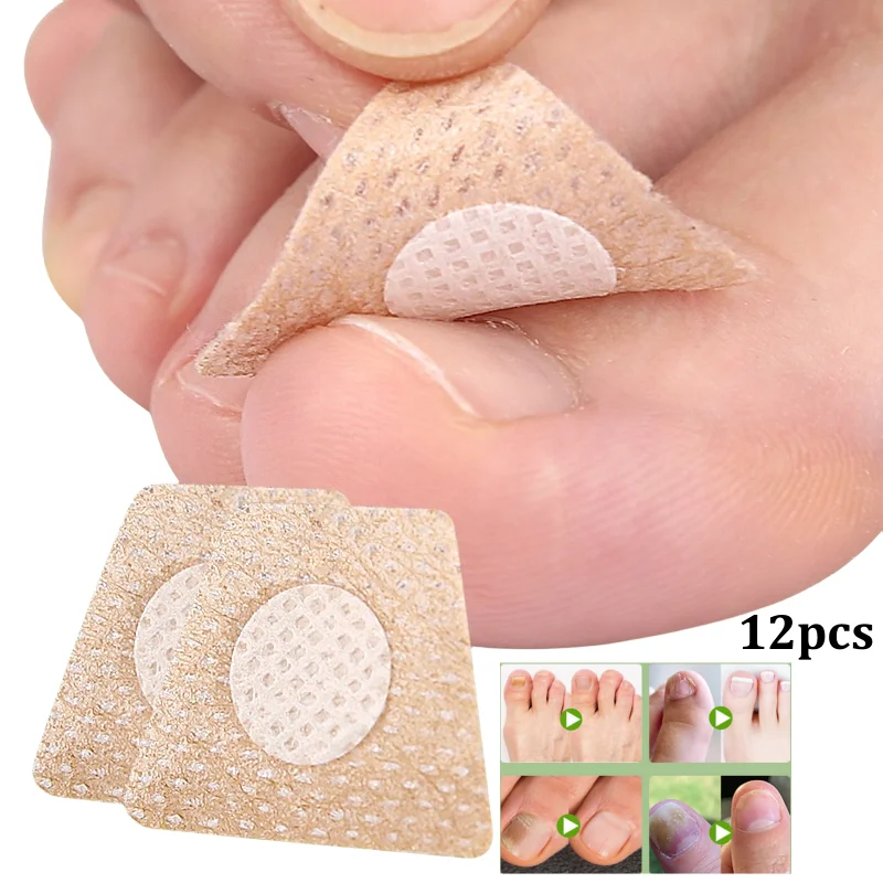 HNKMP Sunlight Official Store