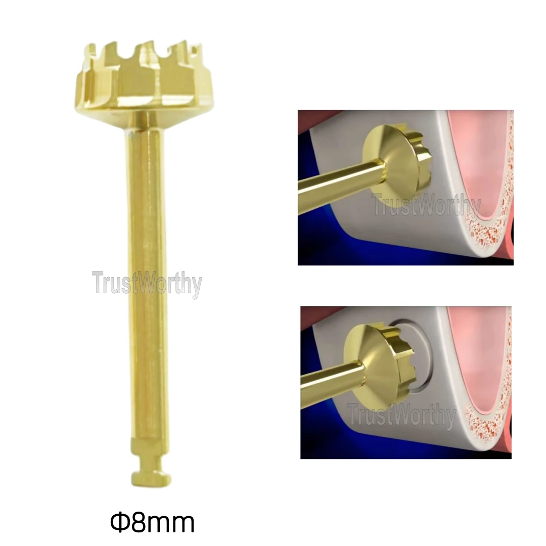 8mm-Dental-Gear-Cutter-Drills-Lateral-Approach-Sinus-Lift-Implant-Burs ...