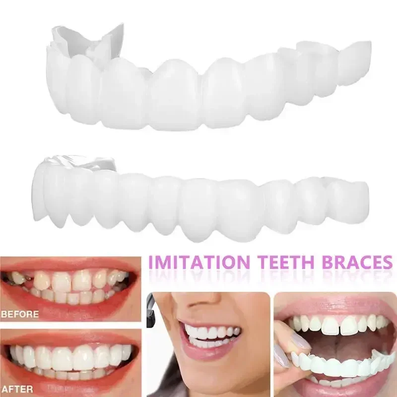 Perfect-Fit-Teeth-Whitening-Fake-Tooth-Cover-Snap-On-Silicone-Smile ...