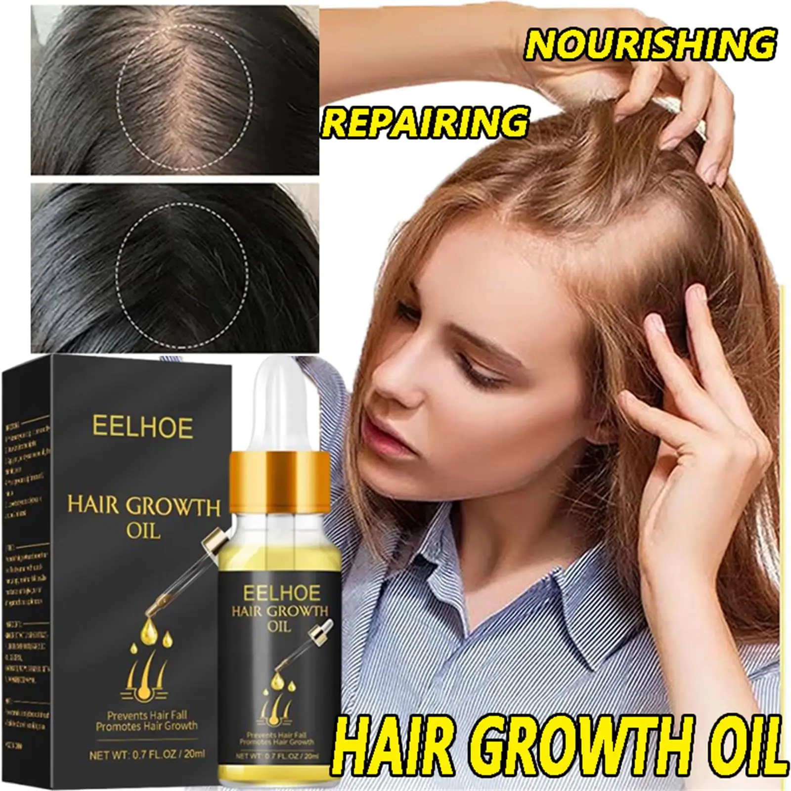 Can You Really Achieve Visible Hair Growth in 3 Months? A Realistic ...