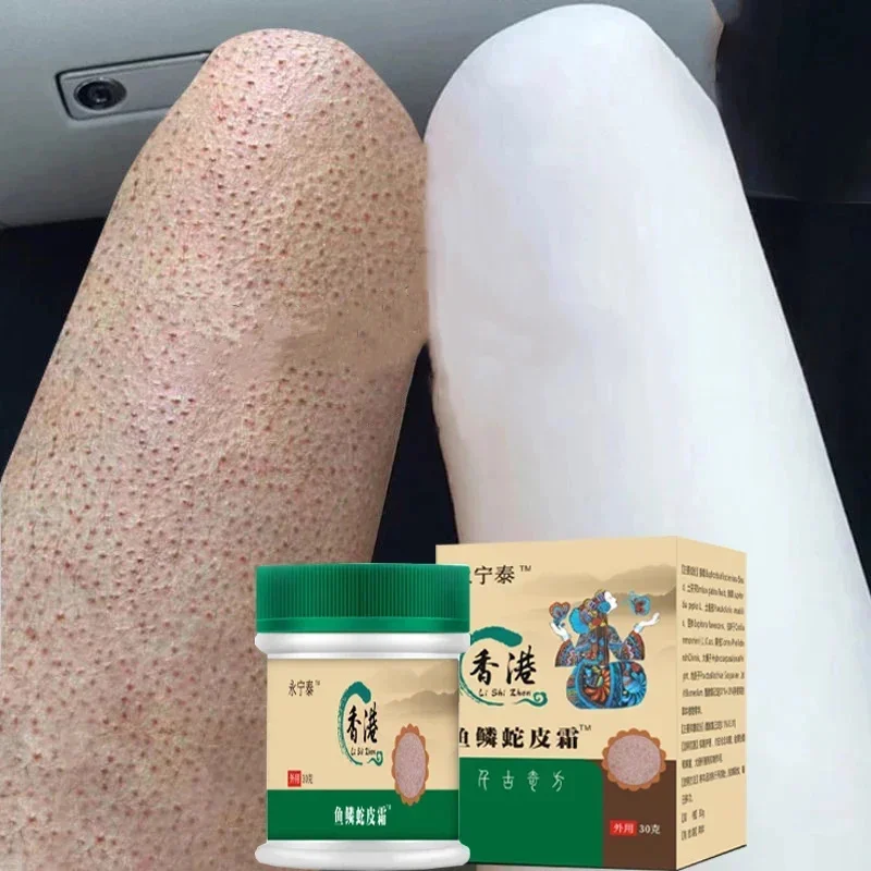 Chicken-Skin-Removal-Treatment-Body-Cream-Repair-Keratosis-Pilaris ...