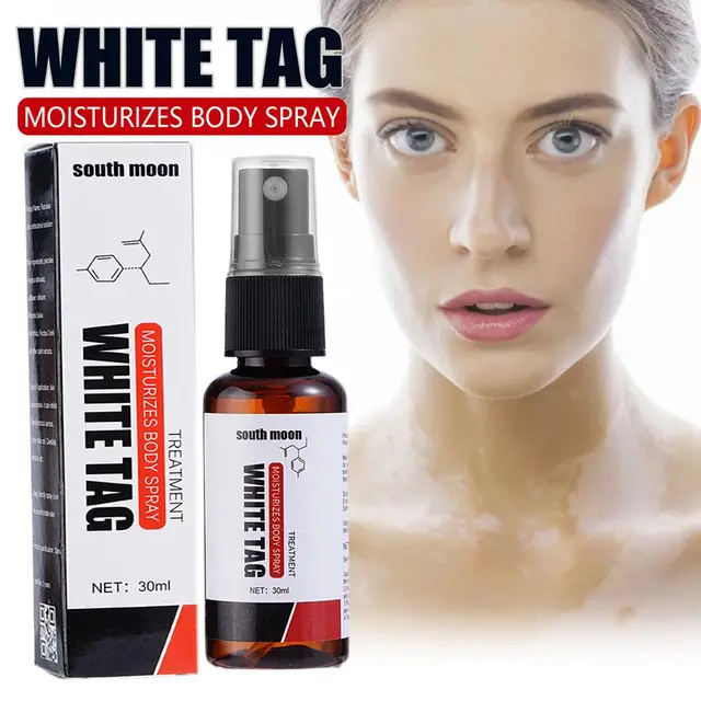 White Spot Remover Spray Herbal Antibacterial Vitiligo Leukoplakia ...