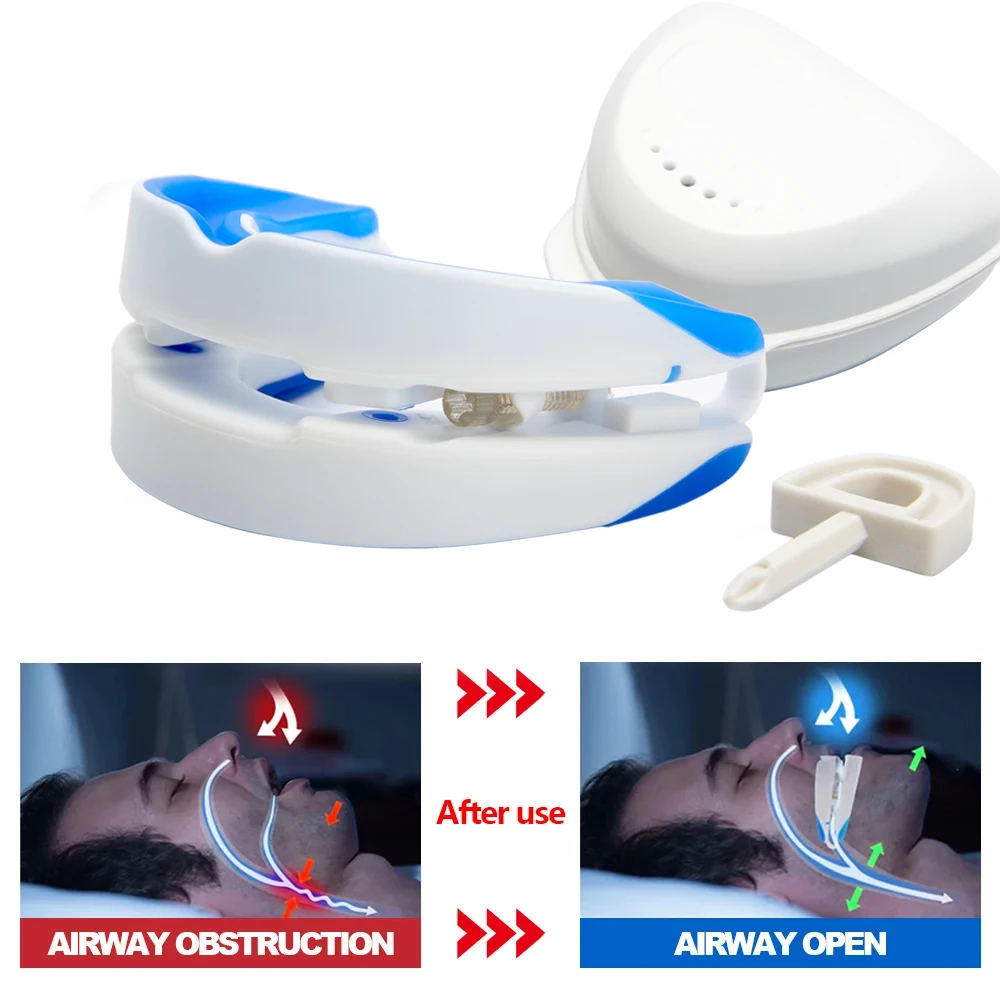 Adjustable-Anti-Snoring-Mouth-Guard-Anti-Snoring-Mouthpiece-Sleeping ...