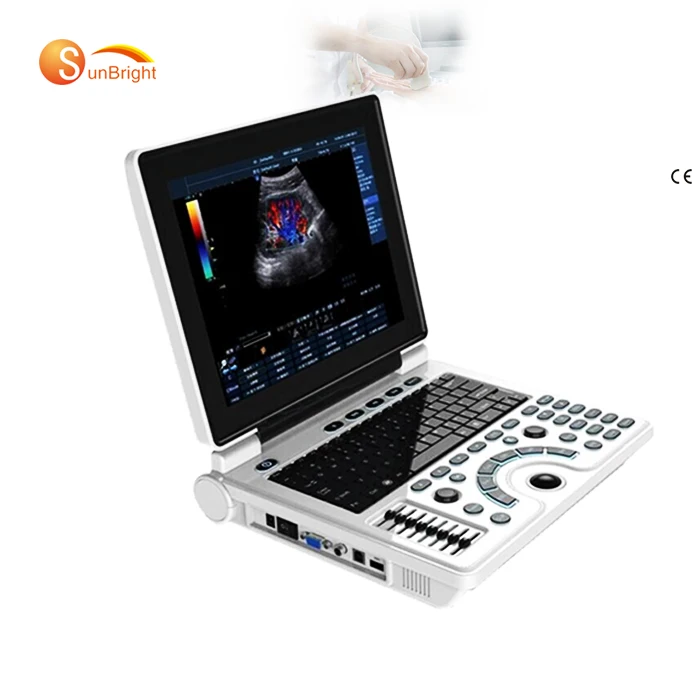 Ecograph-Digital-Ultrasound-Scanner-Obstetr-cia-Laptop-e-Sistema-Diagn ...