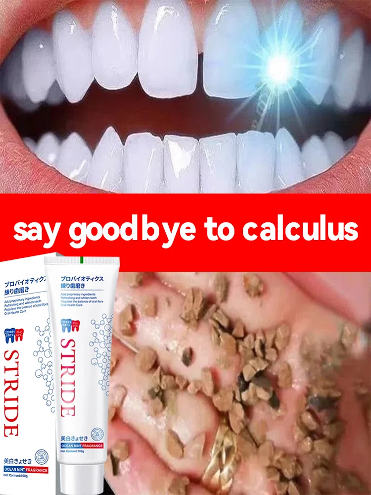 Dental-Calculus-Remover-Toothpaste-Whitening-Teeth-Mouth-Odour-Removal ...