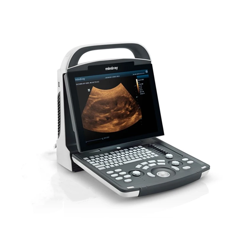 Mindray Dp-10 Original Portable Laptop Ultrasound Machine - Household ...