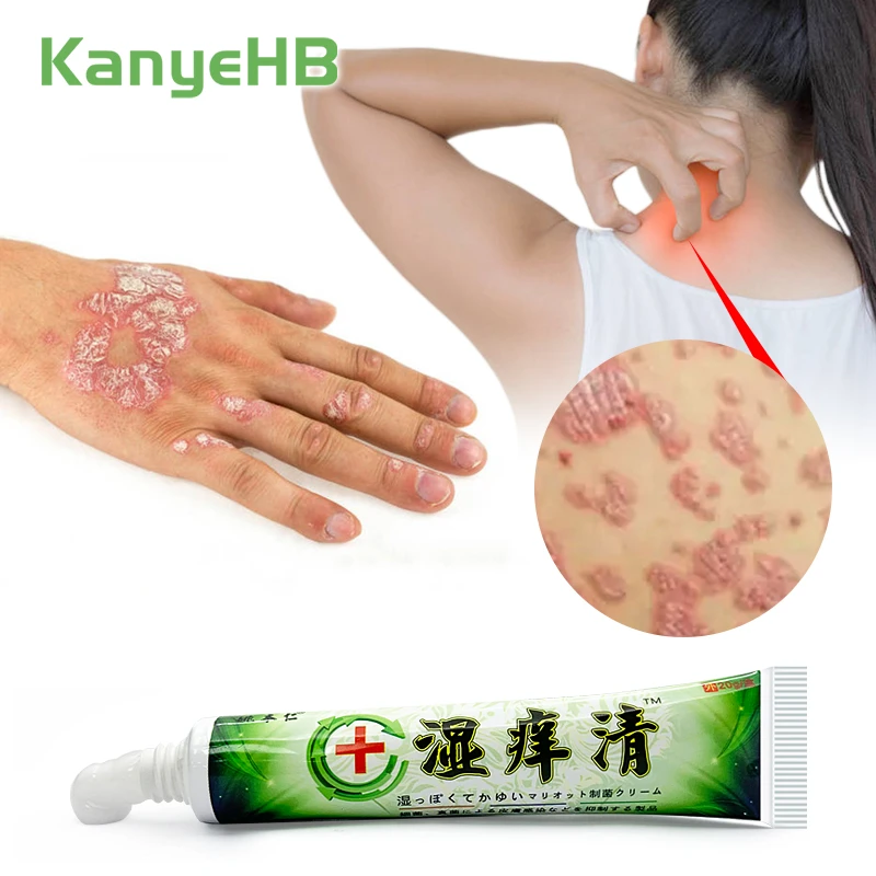 1pcs Psoriasis Ointment Psoriasis Cream Anti-itch Inhibit Fungi Chinese ...