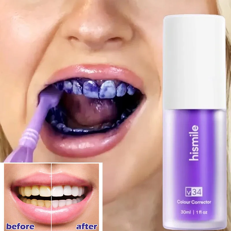 HISMILE-V34-Toothpaste-Purple-Color-Corrector-Toothpaste-For-Teeth ...