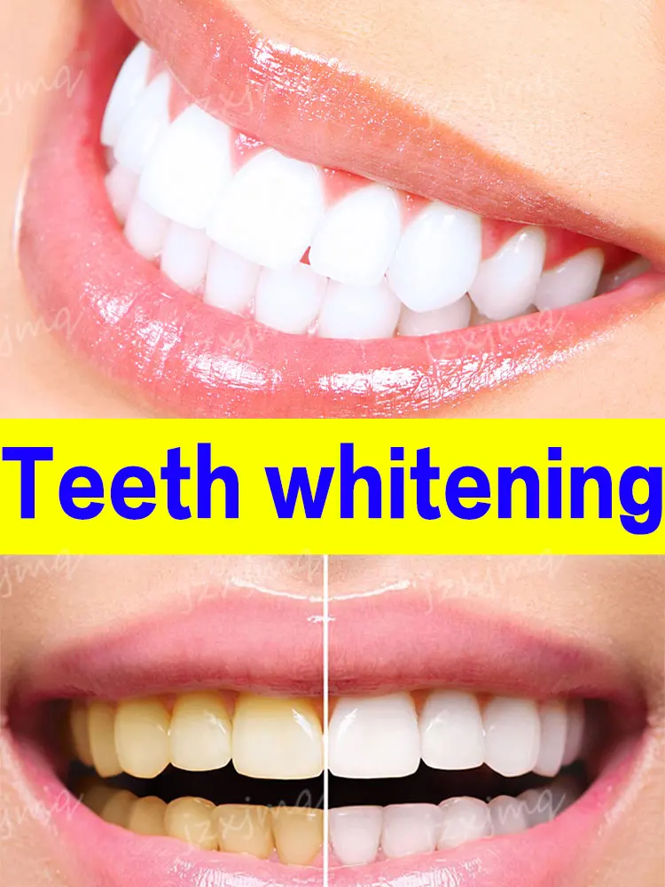 Fast-Teeth-Whitening-Remove-Plaque-Stain.jpg