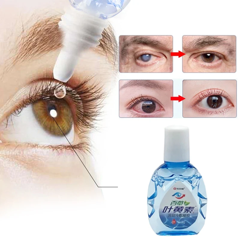 10-5g-Eye-Drop-Antibacterial-Solution-Relieves-Red-Eyes-Discomfort ...