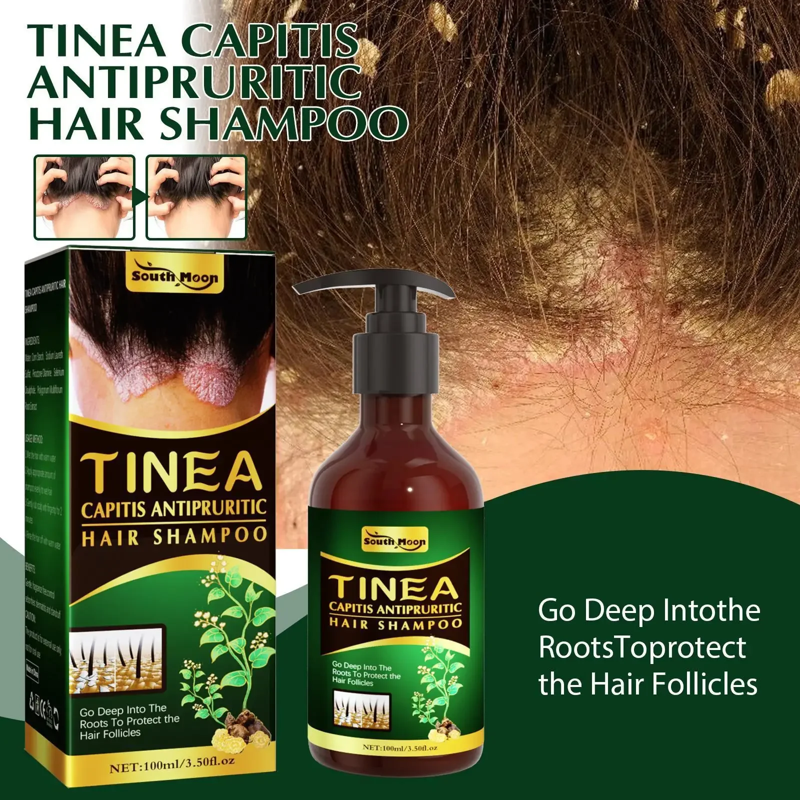 Anti-Itching-Shampoo-Scalp-Seborrheic-Hair-Shampoo-Cream-Remove-Repairs ...