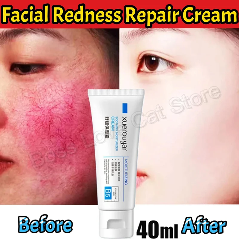 7-Day-Repair-Facial-Redness-Cream-Soothing-Redness-Repair-Skin-Rosacea ...