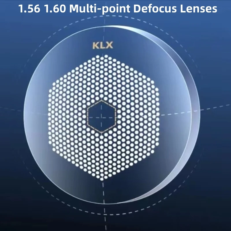 1-56-1-60-Multi-point-Defocus-Anti-blue-Lens-Kids-Teenagers-Eyes-Relief ...