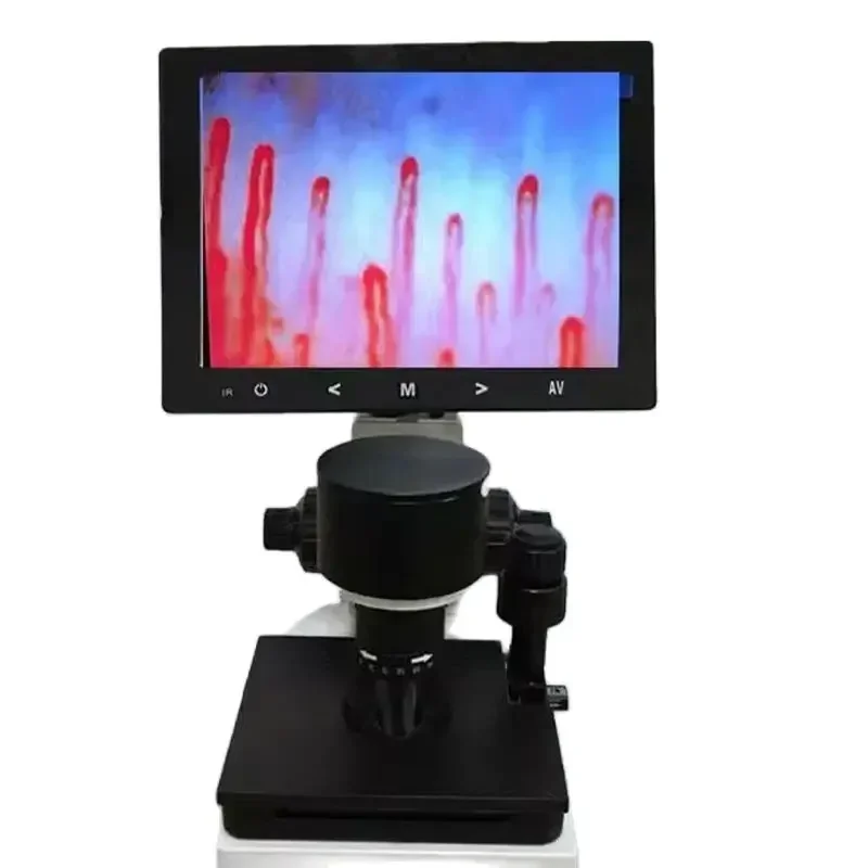 Digital-Microscope-Zoom-Nailfold-Capillary-Microcirculation-Detector-HD ...